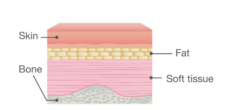 Plicometria e plicometro: cos'è e come funziona? | Project inVictus