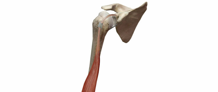 Bicipite brachiale: anatomia e funzioni - Project inVictus