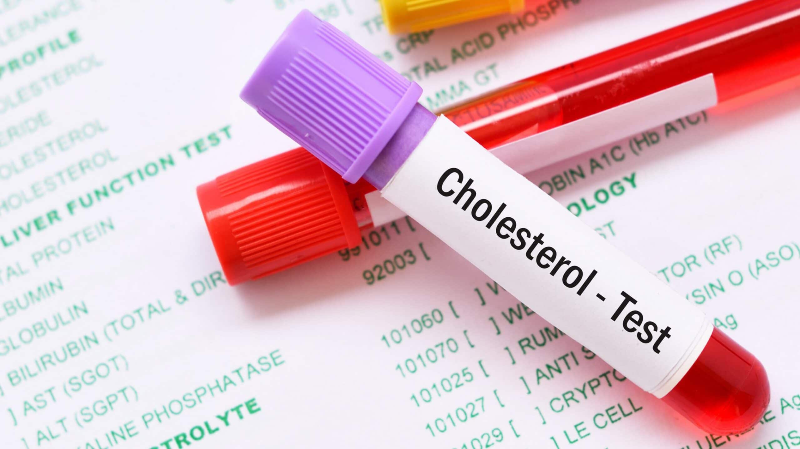 Colesterolo: cos’è e a cosa serve? - Project inVictus