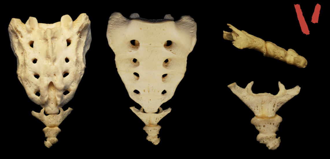 Il coccige: dolore ed anatomia - Project inVictus