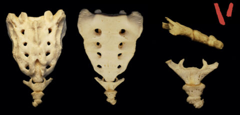 Il coccige: dolore ed anatomia - Project inVictus