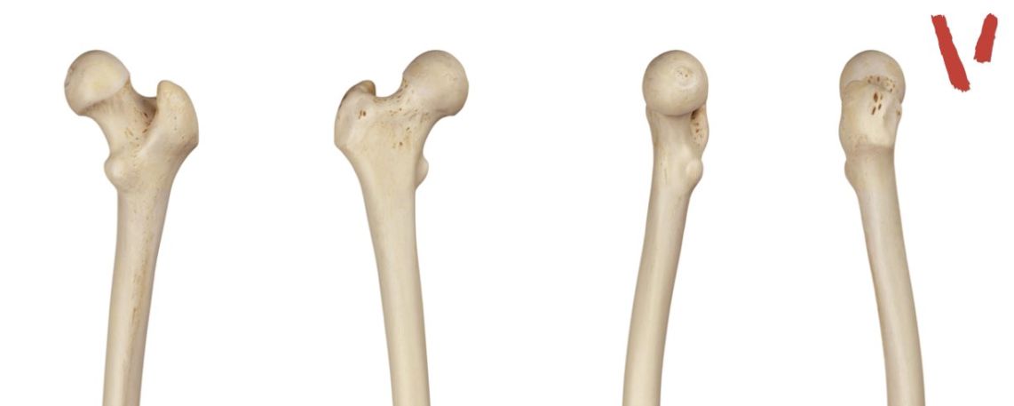 Il grande trocantere: anatomia e funzione - Project inVictus