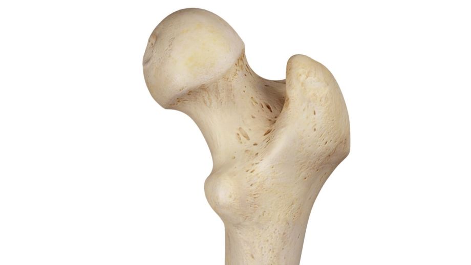 Il piccolo trocantere - Project inVictus