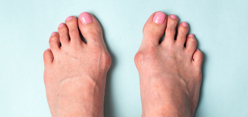 Piede: anatomia e funzioni | Project inVictus