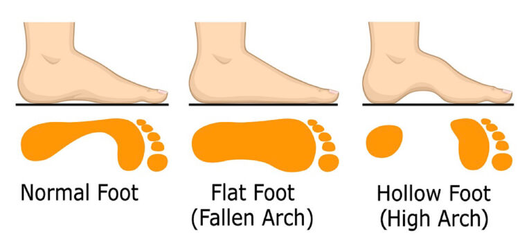Piede: anatomia e funzioni | Project inVictus