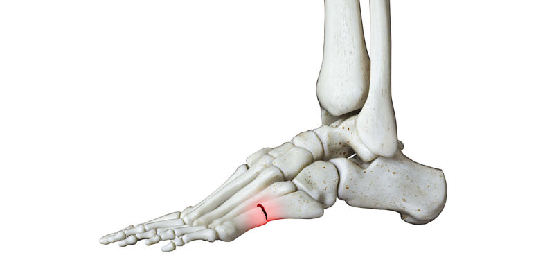 Piede: anatomia e funzioni | Project inVictus