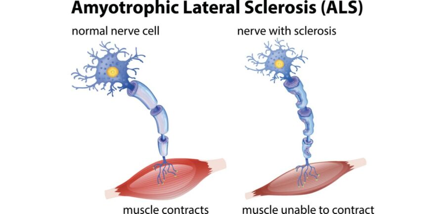 Il motoneurone - Project inVictus
