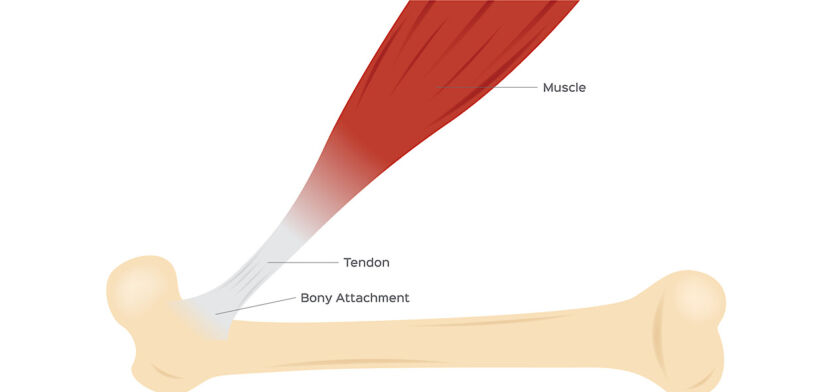 Tendinite alla spalla: cause, sintomi e rimedi - Project inVictus