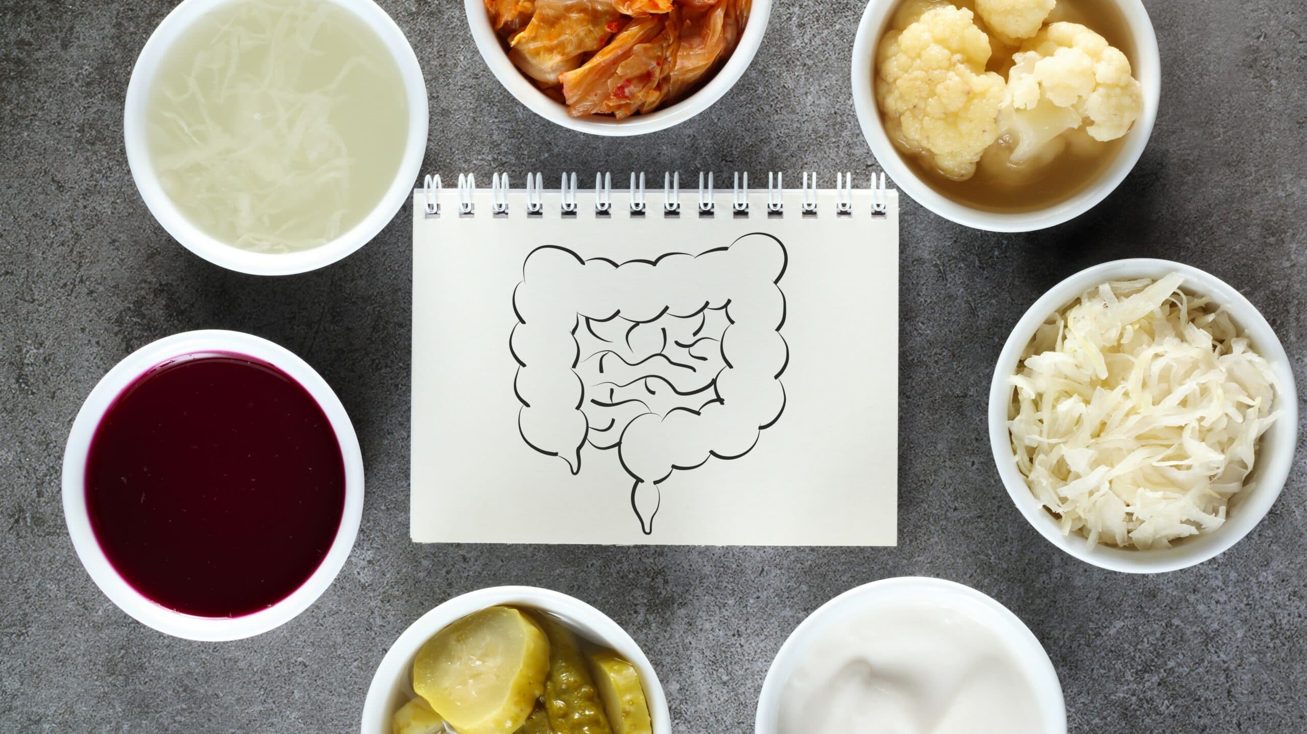 Probiotici: a cosa servono e quali sono i migliori - Project inVictus