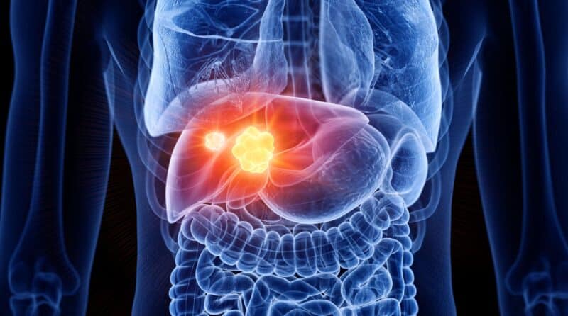 Muscolo grande rotondo: anatomia e funzioni - Project inVictus