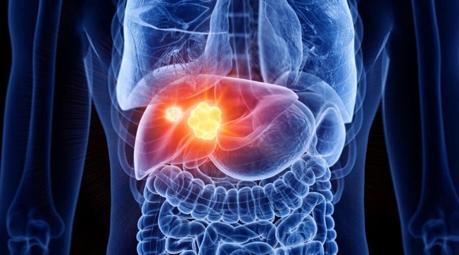 Muscolo gracile: anatomia e funzione - Project inVictus